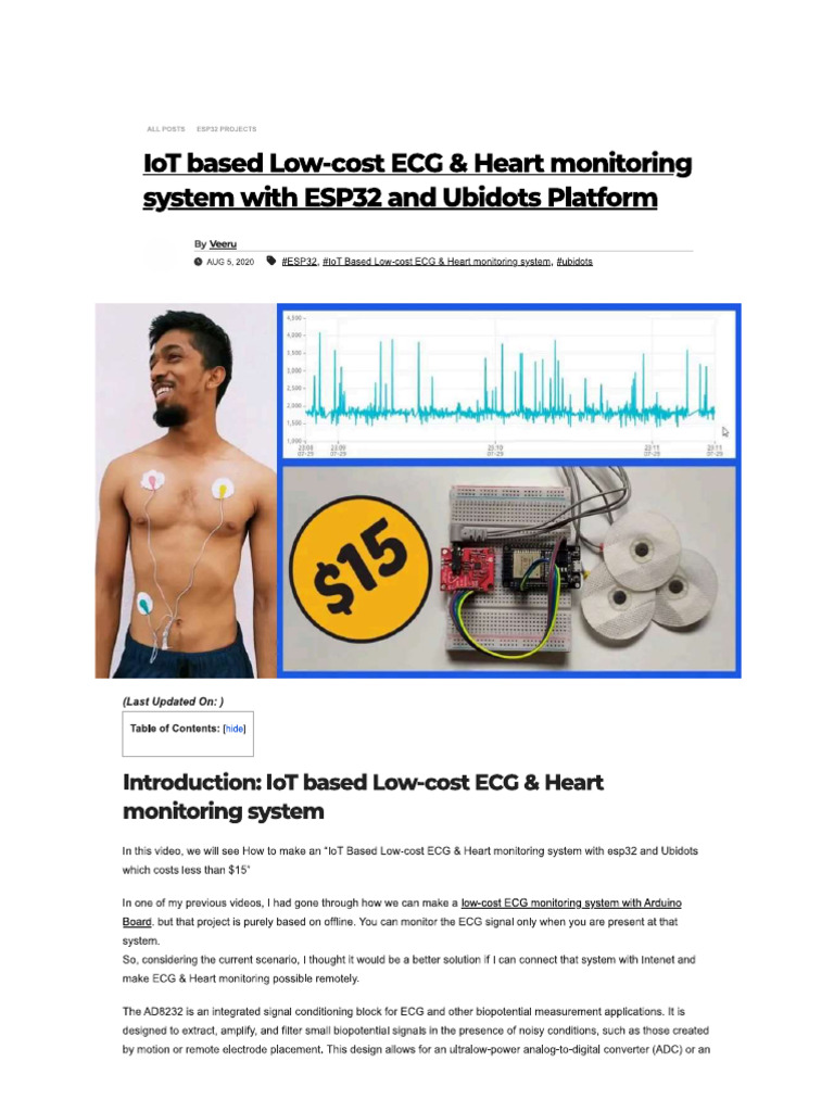 Ecg Project Pdf