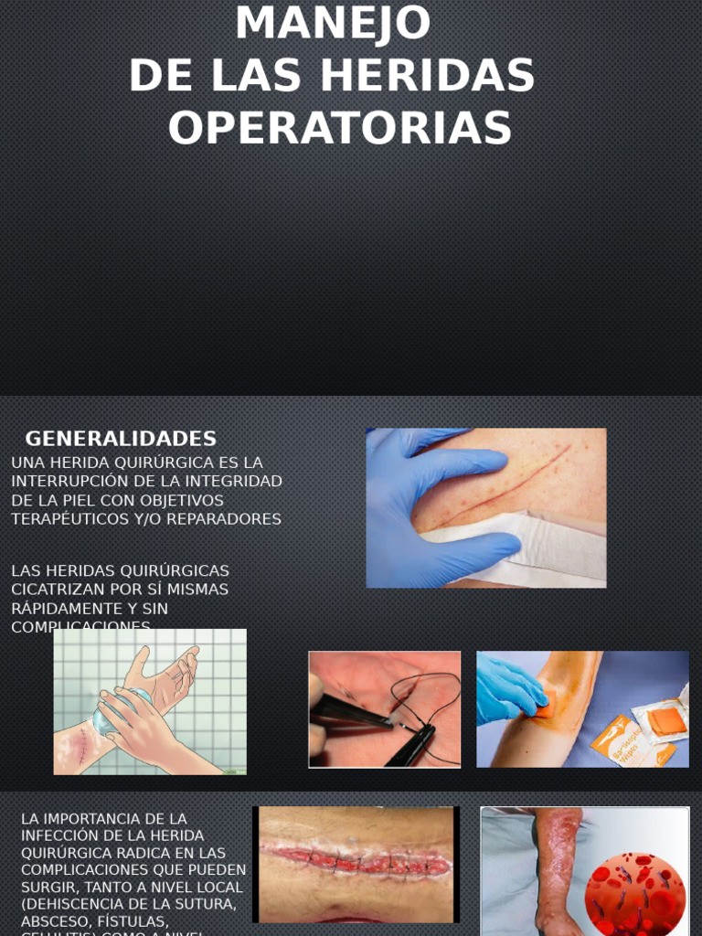 Manejo de Las Heridas Operatorias (Autoguardado) | PDF | Inflamación | Especialidades Medicas