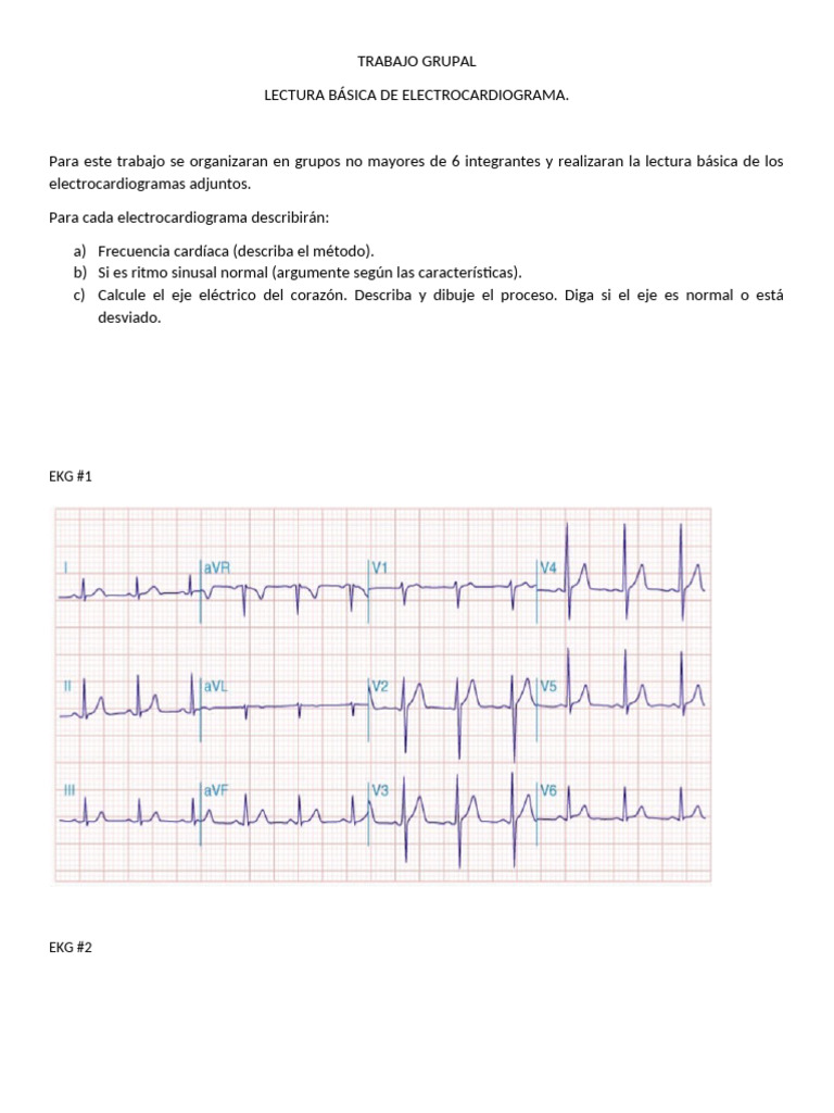 Lectura Básica de Electrocardiogramas | PDF