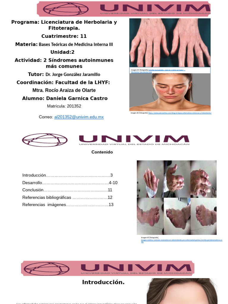 U2 Act.2 Síndromes Autoinmunes Más Comunes | PDF | Gota | Artritis