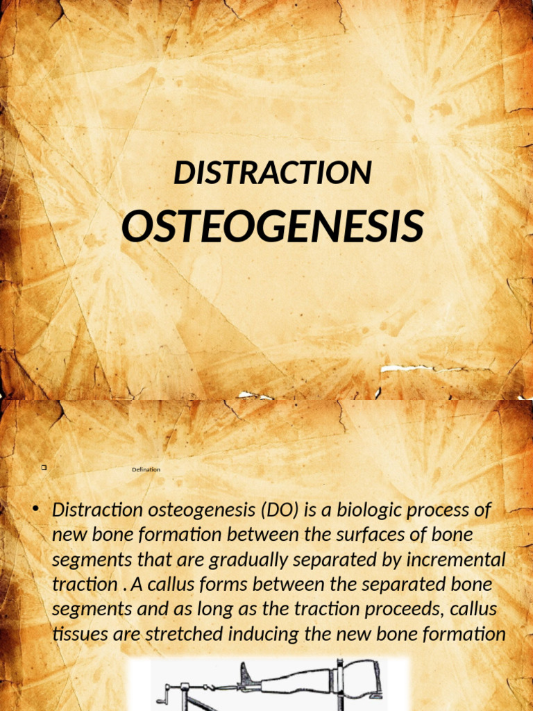 Distraction Osteogenesis Overview and Phases | PDF | Medical ...