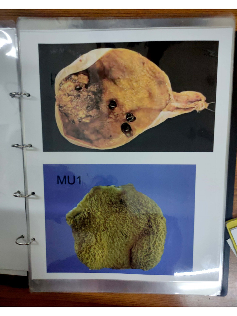 Surgery specimen | PDF