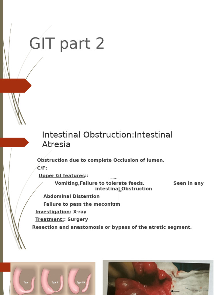 Congenital Surgical Conditions-1 | PDF | Gastrointestinal Tract ...
