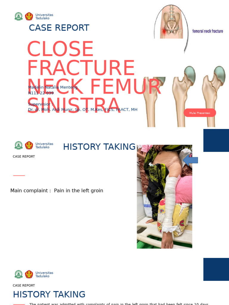 Case Report: Left Femoral Neck Fracture | PDF | Anatomical Terms Of ...