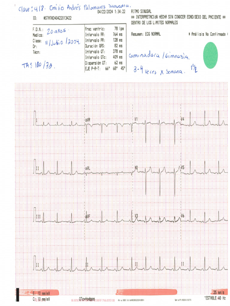 418-Palomares Saavedra Emilio Andres Ekg | PDF