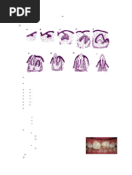 Ulectomia e Ulotomia. | PDF