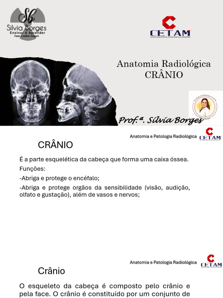 Anatomia do Crânio em Radiologia | PDF | Crânio | Sistema Locomotor