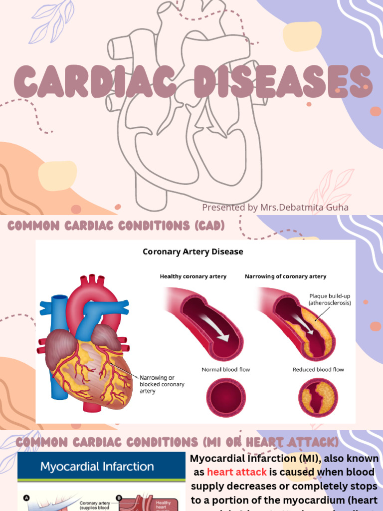 Cardiac Diseases | PDF