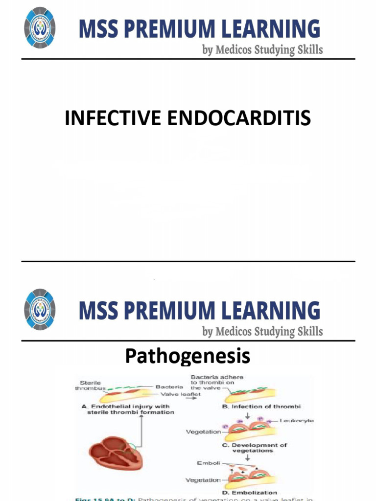 Infective Endocarditis Overview and Management | PDF | Heart Valve ...