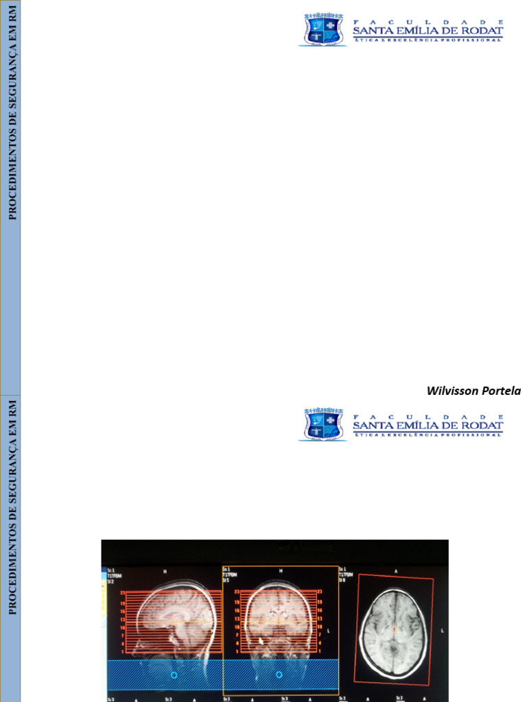 Aula 5 Protocolos RM | PDF
