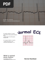 Abnormal ECG Findings in Athletes | PDF | Electrocardiography | Cardiac ...
