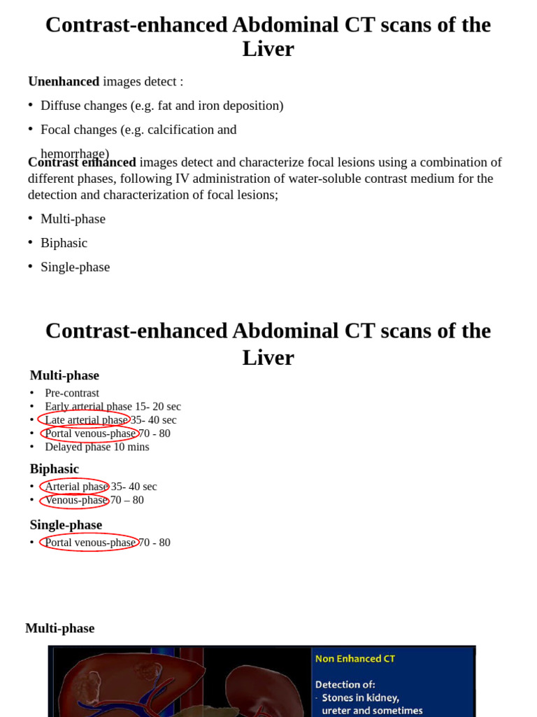 Liver CT Anatomy | PDF
