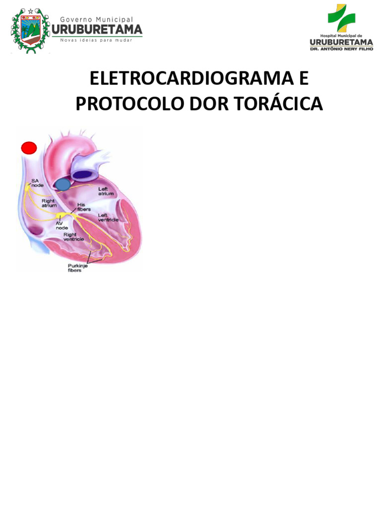 Eletrocardiograma e Protocolo Dor Torácica - Hospital de Uruburetama | PDF | Dor | Remédio
