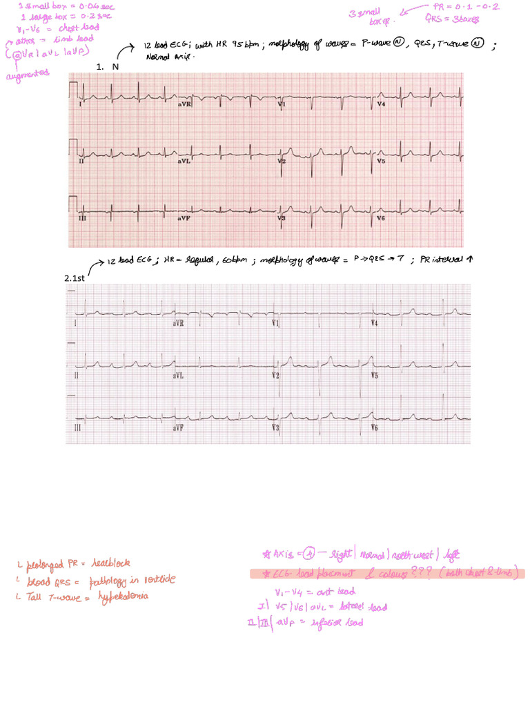 ECG Med ALL | PDF