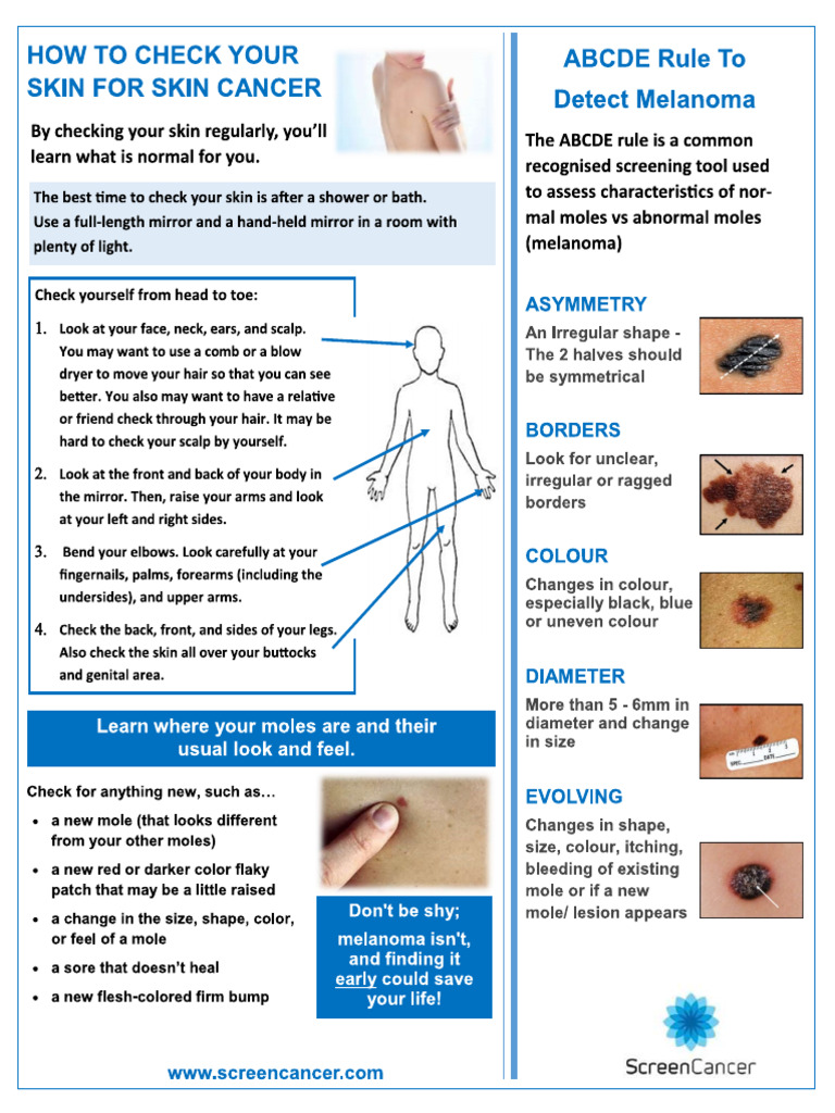 ABCDE Poster | PDF
