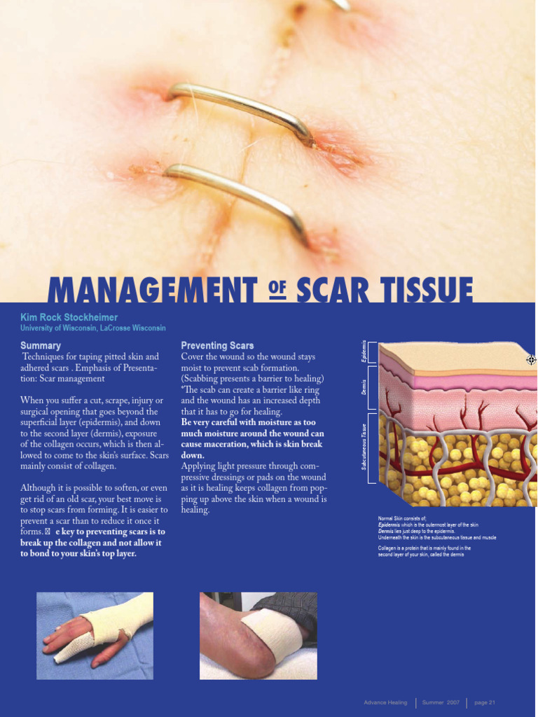 Effective Scar Tissue Management Techniques | PDF | Diseases And Disorders