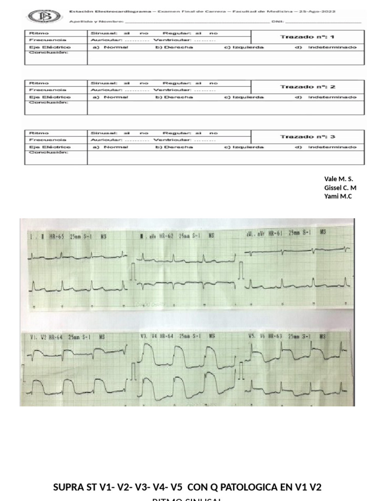 Ecg Diciembre 2024 | PDF | Enfermedades y trastornos | Electrofisiologia