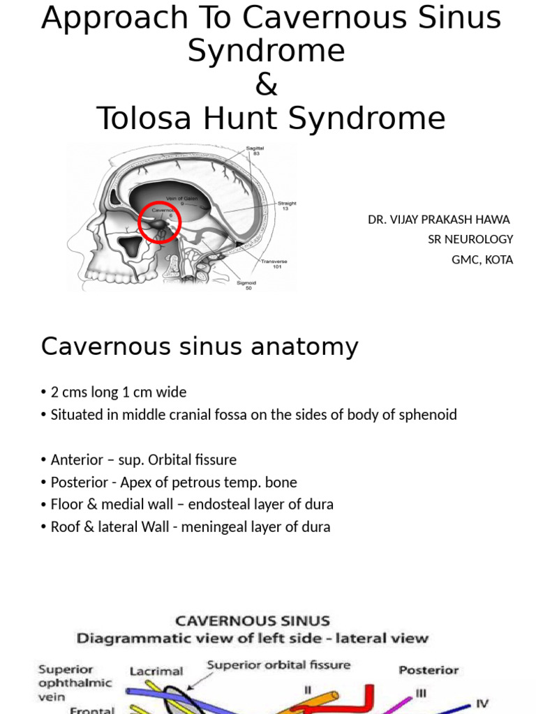 Cavernous Sinus & Tolosa Hunt Syndrome Guide | PDF | Diseases And ...
