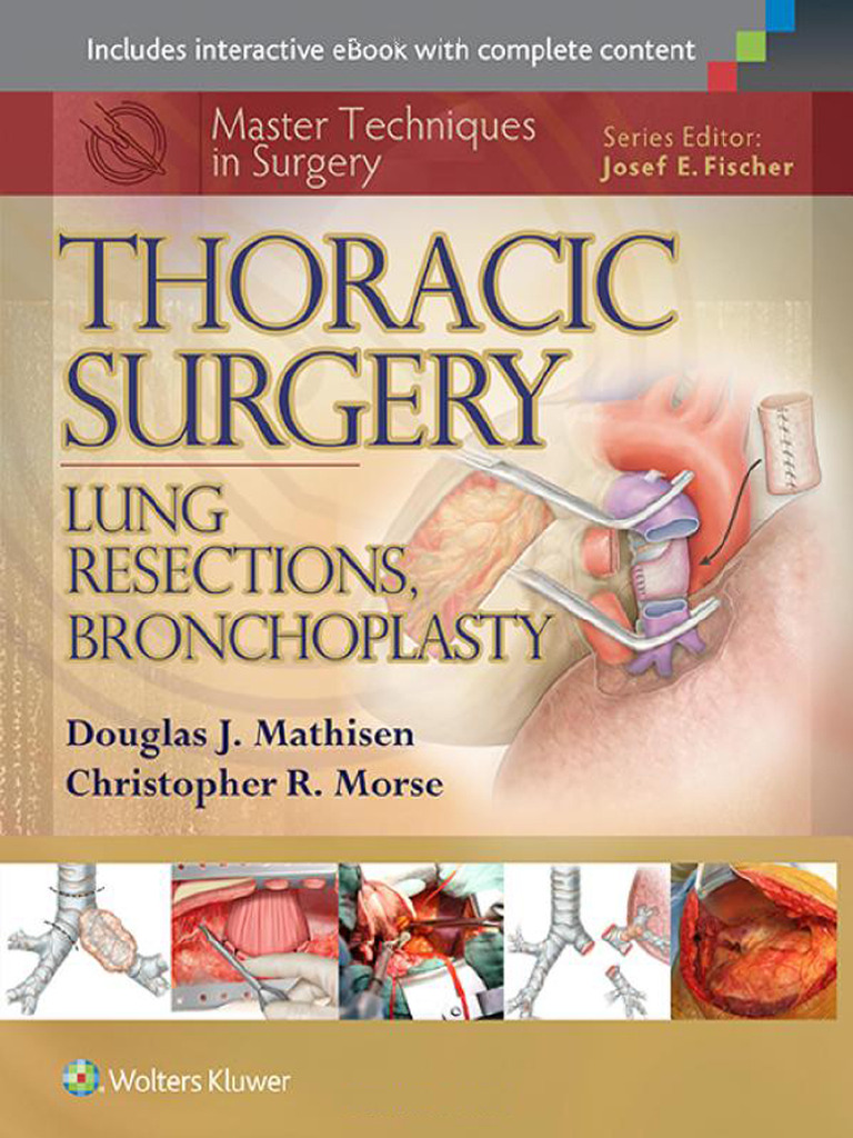 Master Techniques in Surgery - Thoracic Surgery - Lung Resections, Bronchoplasty (PDFDrive ...