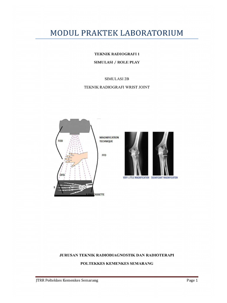 2B Modul Wrist Joint | PDF