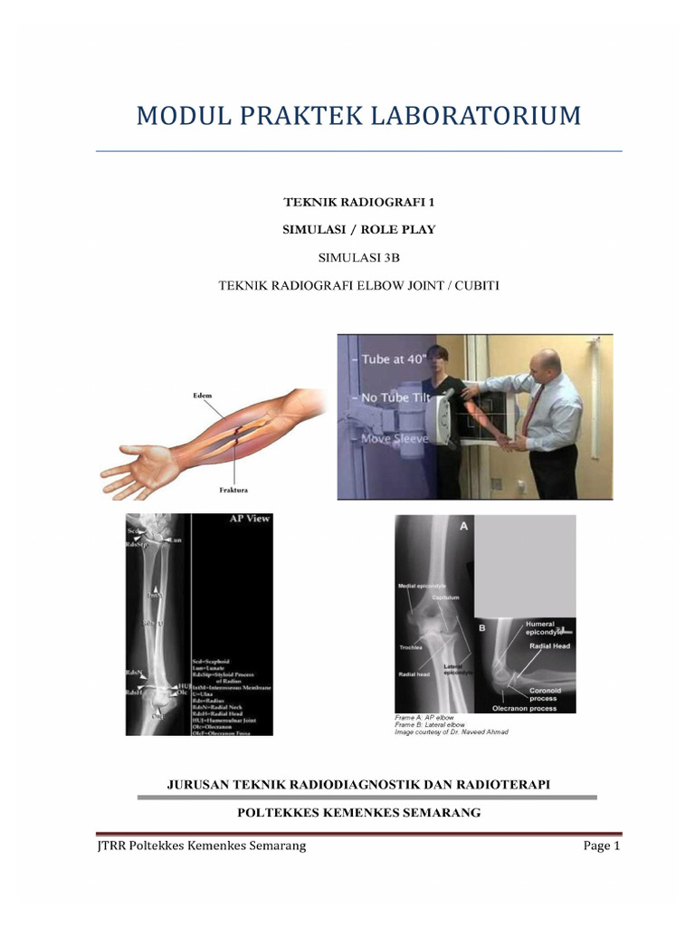 3B Modul Elbow Joint (Cubiti) | PDF