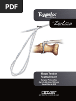Mini Tightrope CMC Fixation | PDF | Thumb | Musculoskeletal System