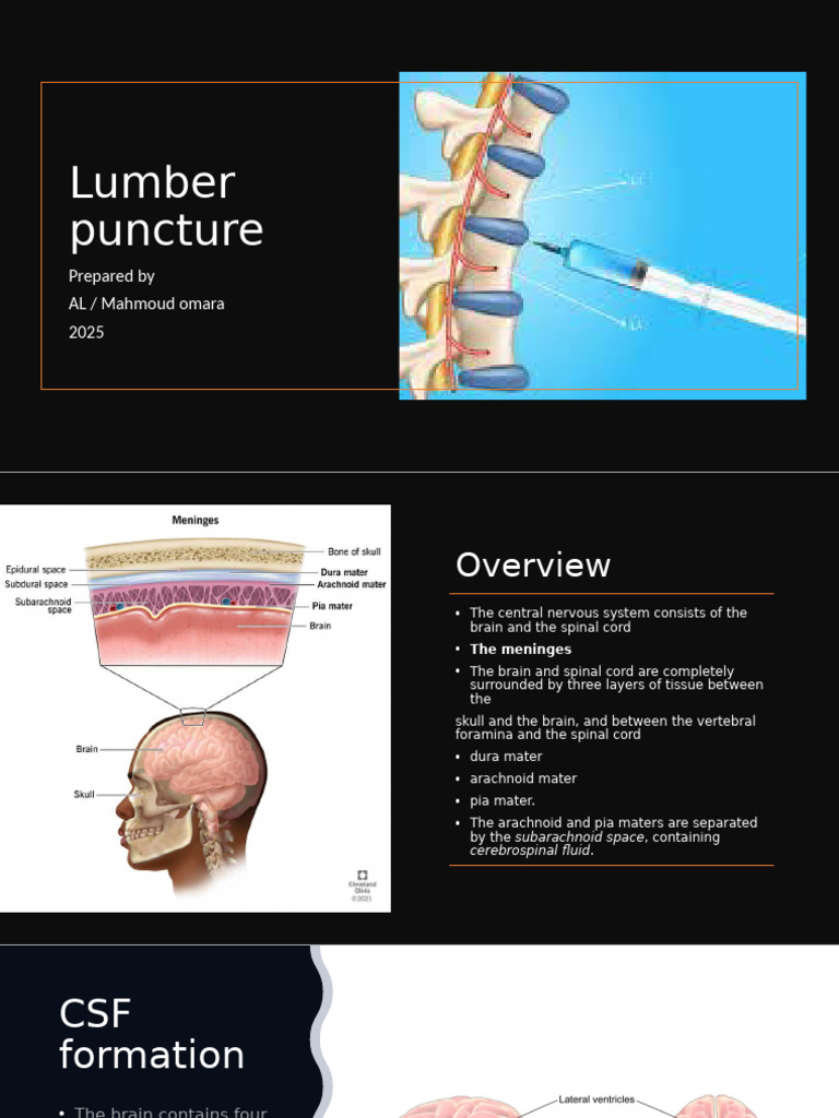 Understanding Lumbar Puncture Procedures | PDF | Cerebrospinal Fluid ...