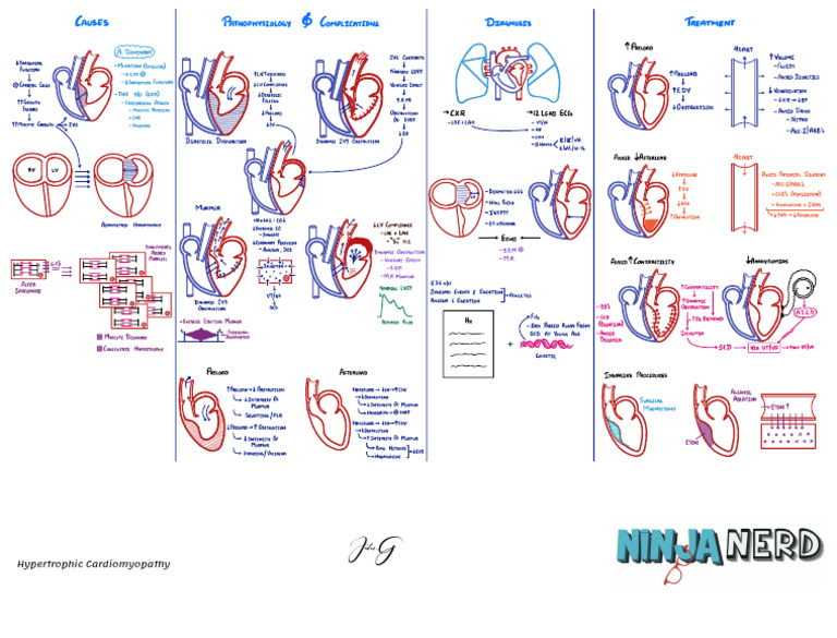 10130120 - Cardiovascular Pathology - 012 ] Hypertrophic Cardiomyopathy ...
