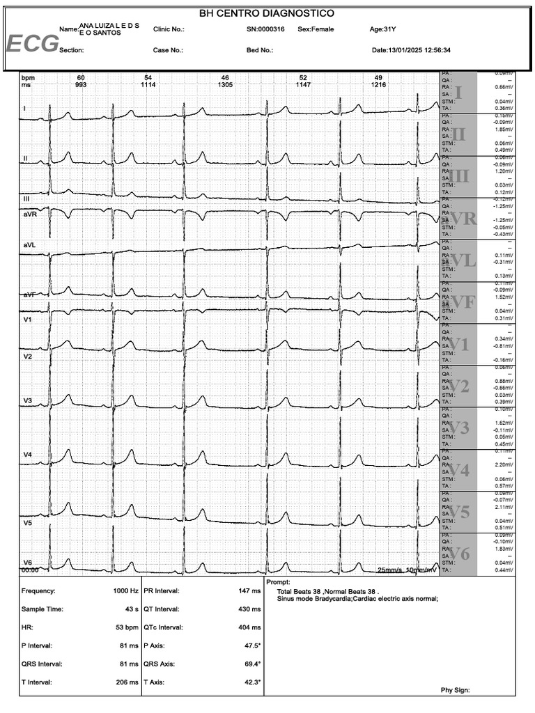 ECG Report for Ana Luiza Santos | PDF | Cardiac Arrhythmia ...