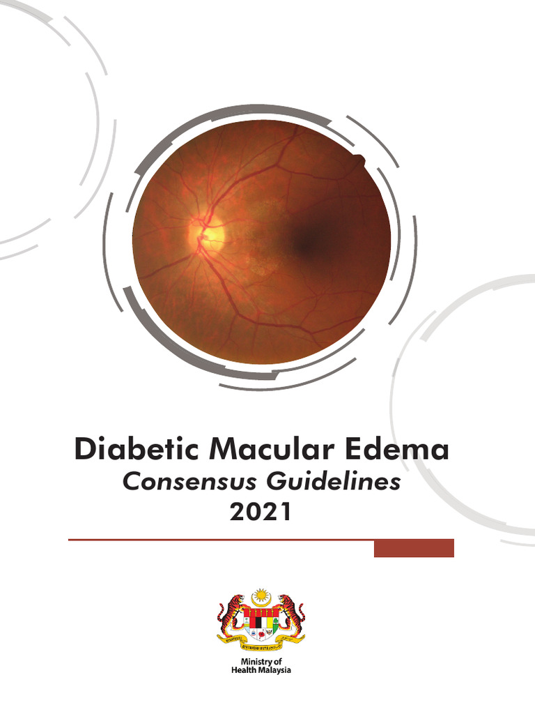 Malaysian DME Consensus Guidelines 2021 | PDF | Retina | Ophthalmology