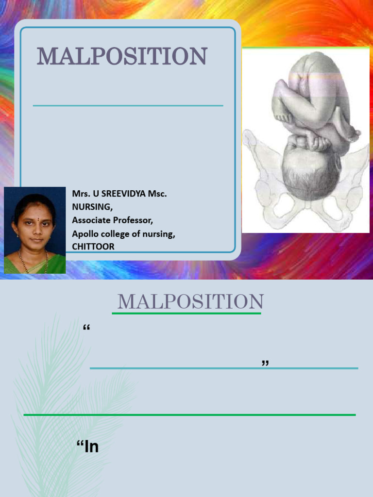 Understanding Occipito-Posterior Position | PDF | Pelvis | Childbirth