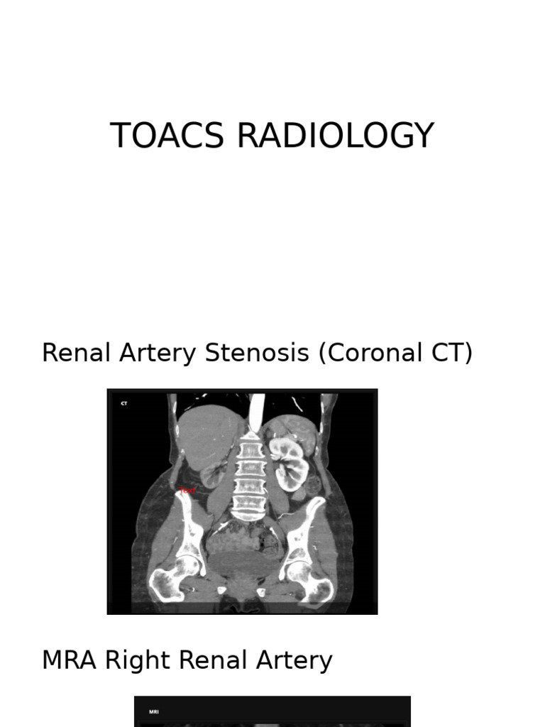Toacs Radiology and Images | PDF | Kidney | Medical Specialties