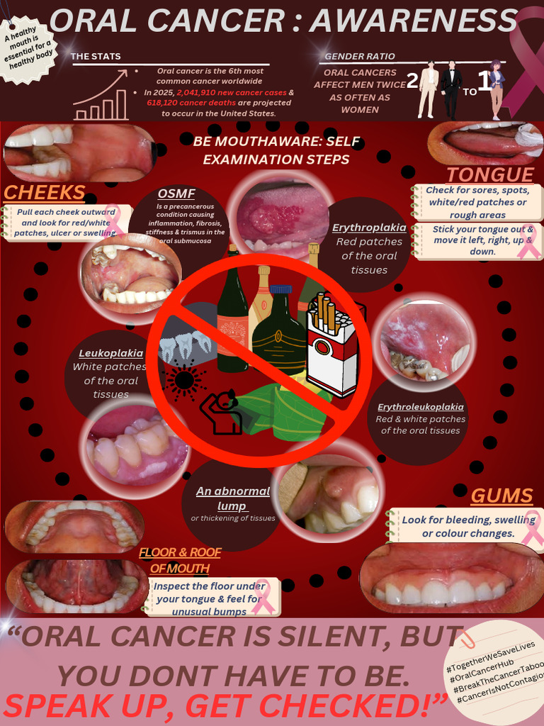 Oral Cancer Awareness and Self-Examination | PDF | Diseases And ...