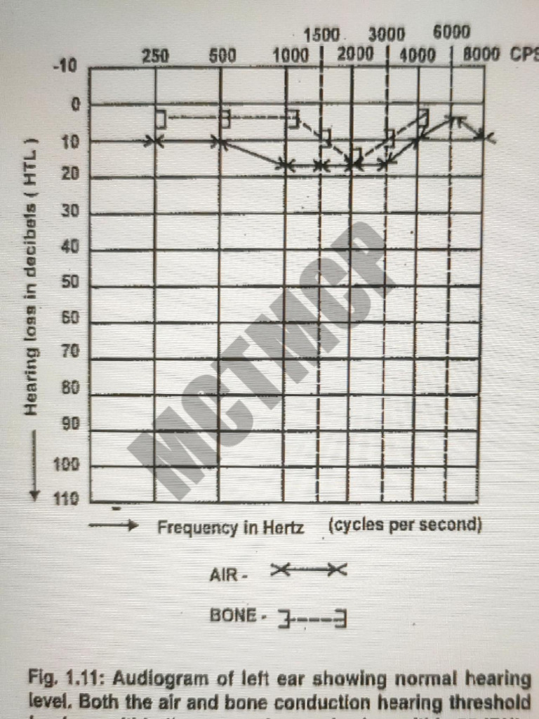 ENT Charts PTA | PDF
