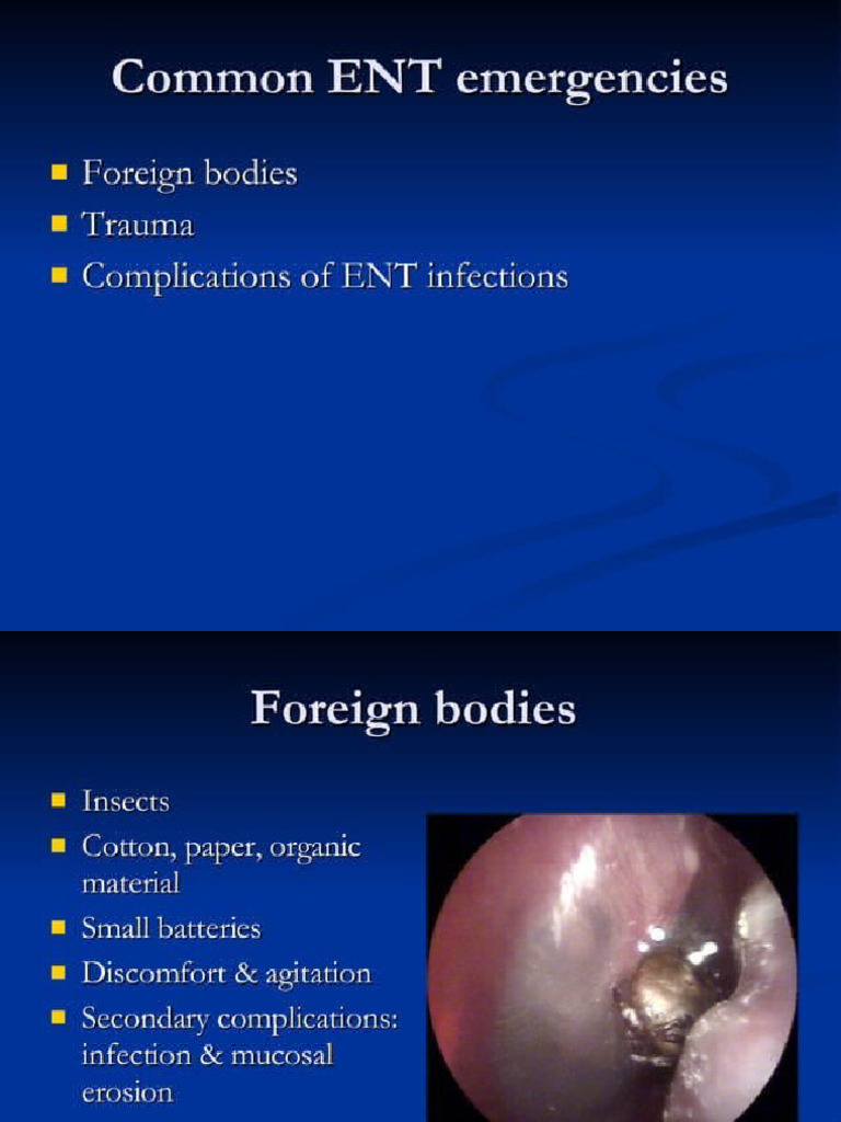 Common ENT Emergency | PDF