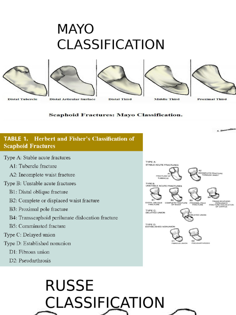 SCAPHOID # | PDF