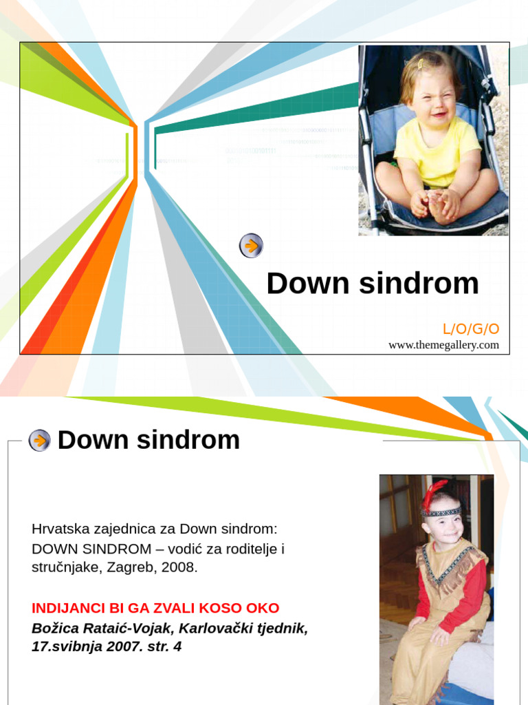 Down Sindrom | PDF