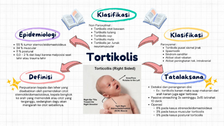 Tortikolis | PDF