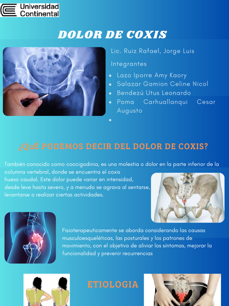 Alivio del dolor en el coxis | PDF | Artritis | Dolor