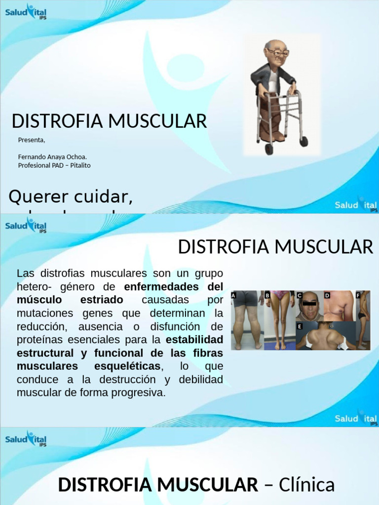 Manejo Distrofia Muscular | PDF | Músculo | Enfermedades y trastornos ...