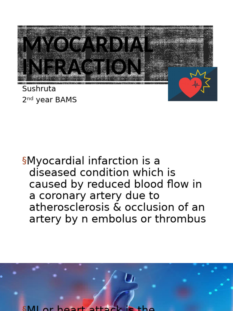 Myocardial Infraction: Sushruta 2 Year BAMS | PDF | Myocardial ...