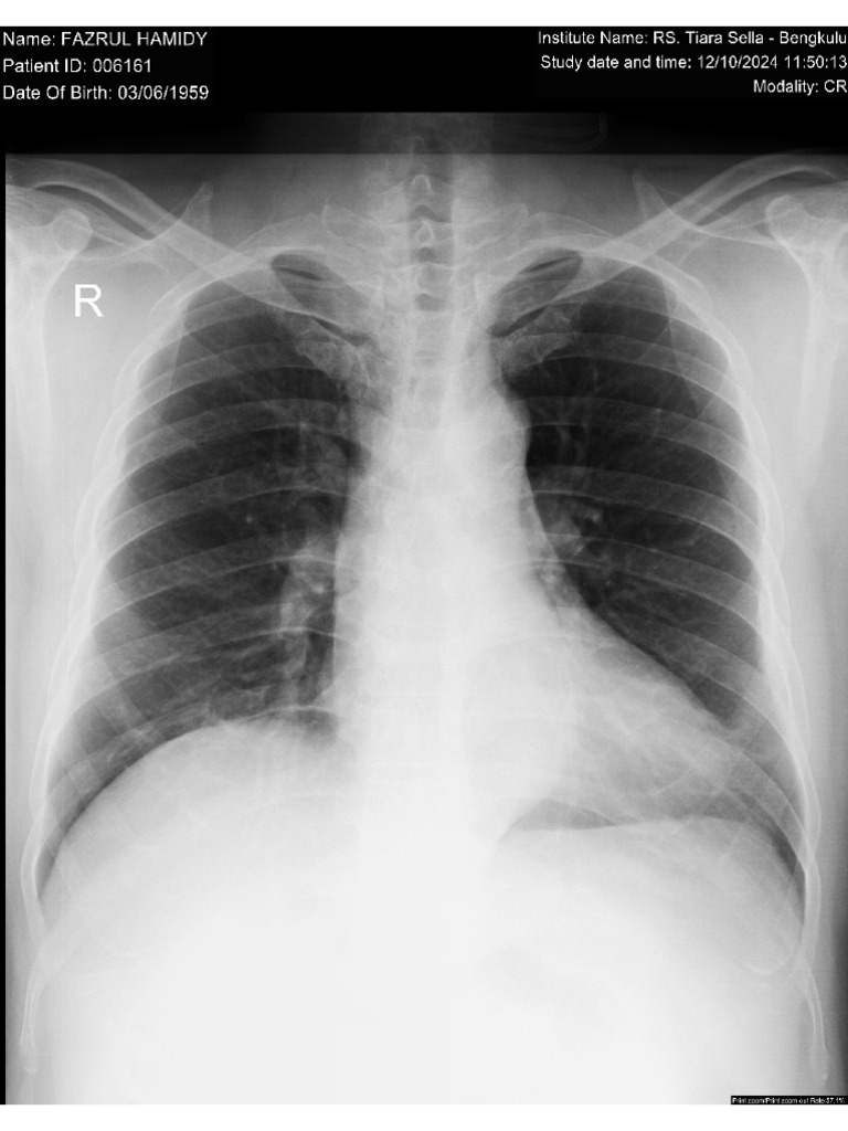 tn. fazrul hamidy | PDF