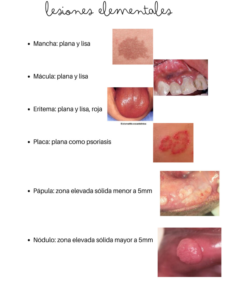 Lesiones Elementales | PDF