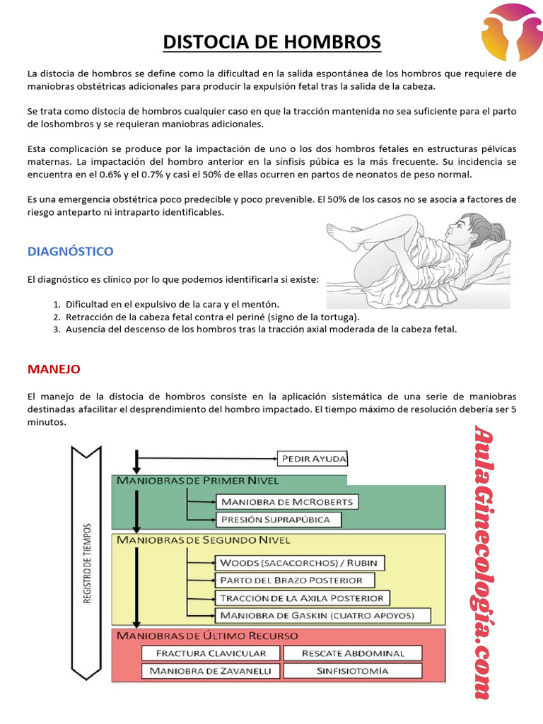 Distocia de Hombros | PDF | Parto | Hombro
