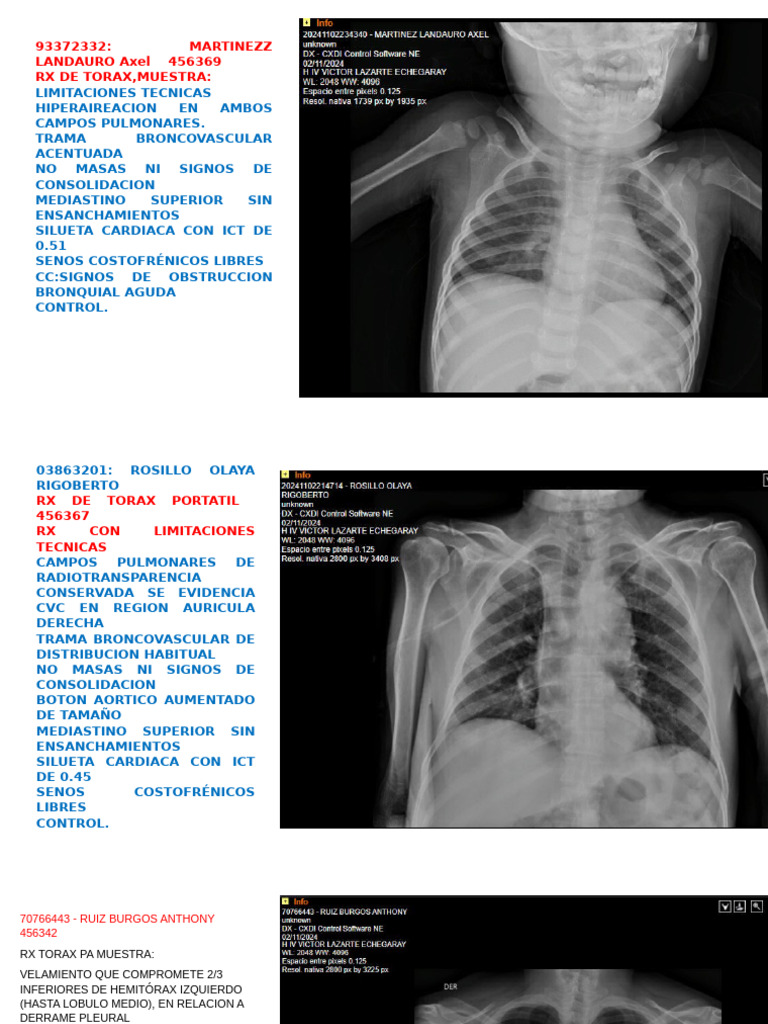 Informes RX Torax | PDF | Pulmón | Tórax