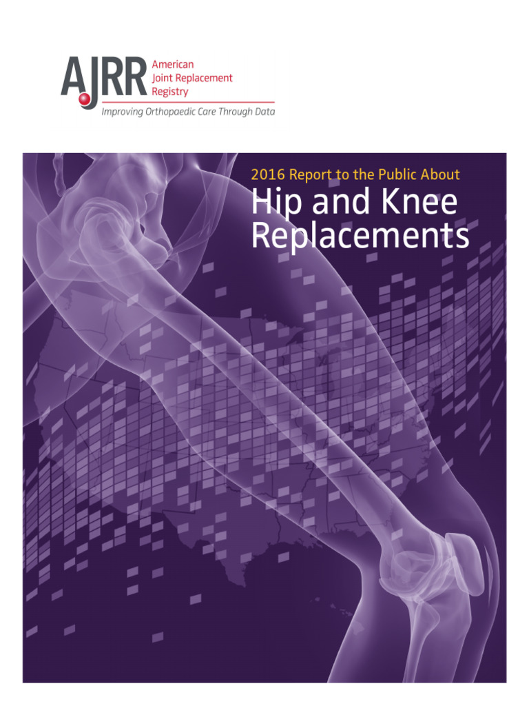 Joint Replacement Insights 2016 | PDF | Surgery | Patient