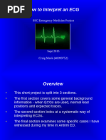 STEMI 12 Lead ECG Analysis Guide | PDF | Electrocardiography | Visual ...