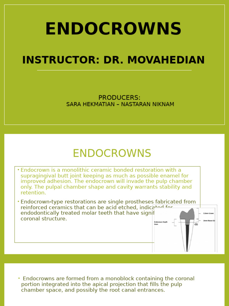 Endo Crowns | PDF | Dental Composite | Dental Anatomy