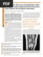 Acl Tightrope Attachable Button System | PDF | Musculoskeletal System ...