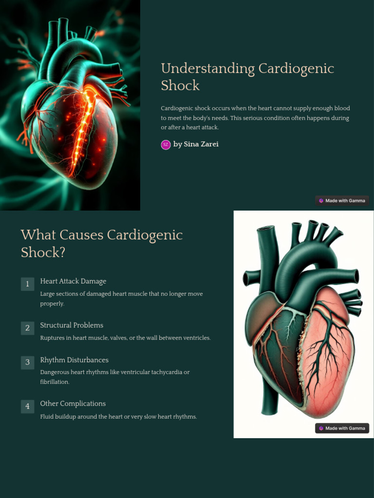 Understanding-Cardiogenic-Shock | PDF | Heart | Myocardial Infarction